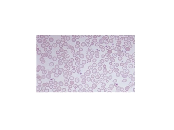 Introduction THE HAEMOGLOBIN MOLECULE Human haemoglobin is formed