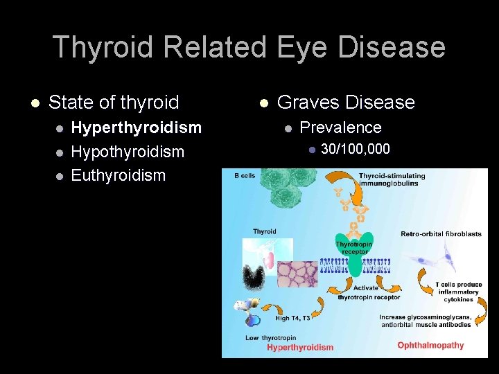 Thyroid Related Eye Disease Jackson Lever MD Country