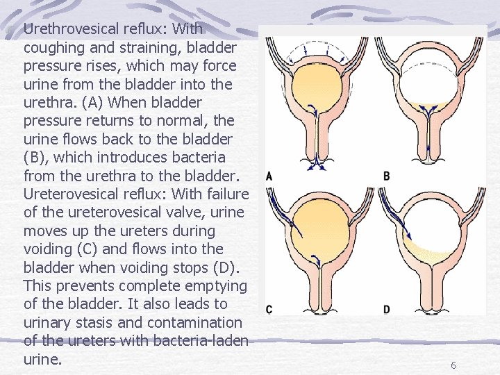 Chapter 45 Management of Patients with Urinary Disorders