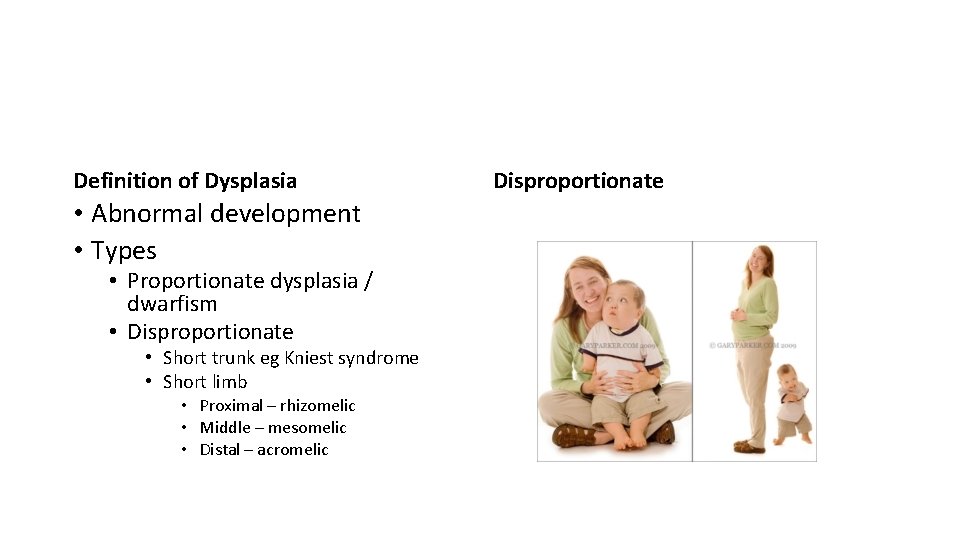 Bone Dysplasia Definition of Dysplasia Abnormal development Types