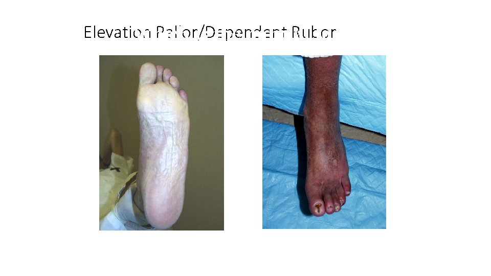 The Approach to the Patient with PAD Questions