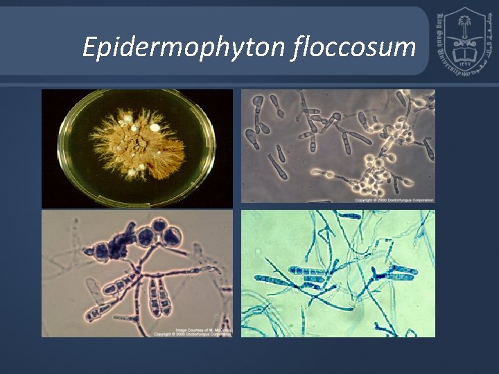 Lecture Title Fungal Infections of the skin Superficial
