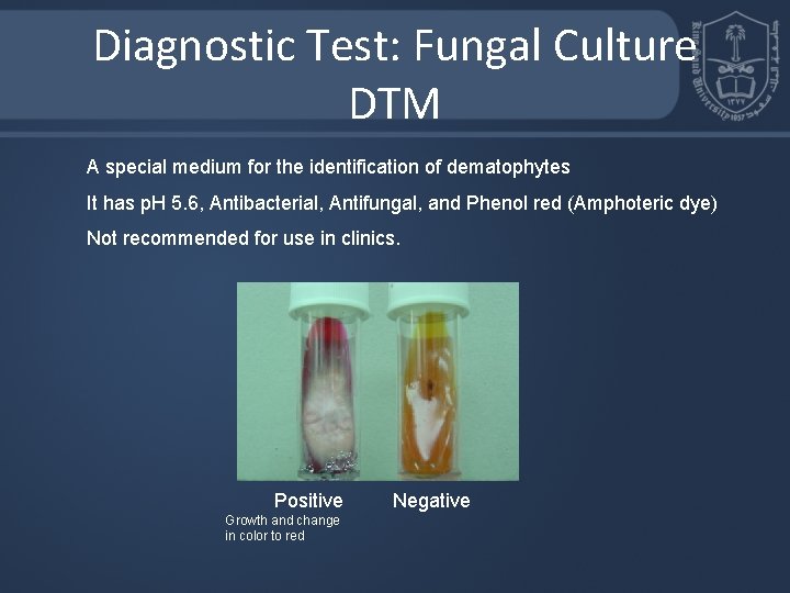 Lecture Title Fungal Infections of the skin Superficial