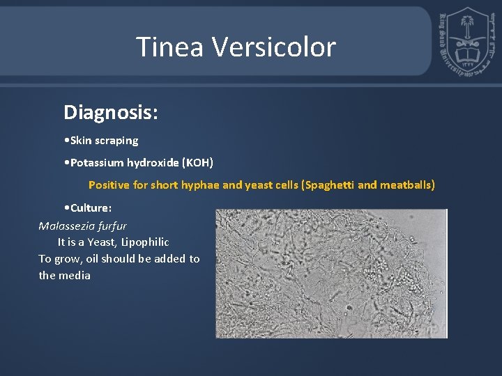 Lecture Title Fungal Infections of the skin Superficial