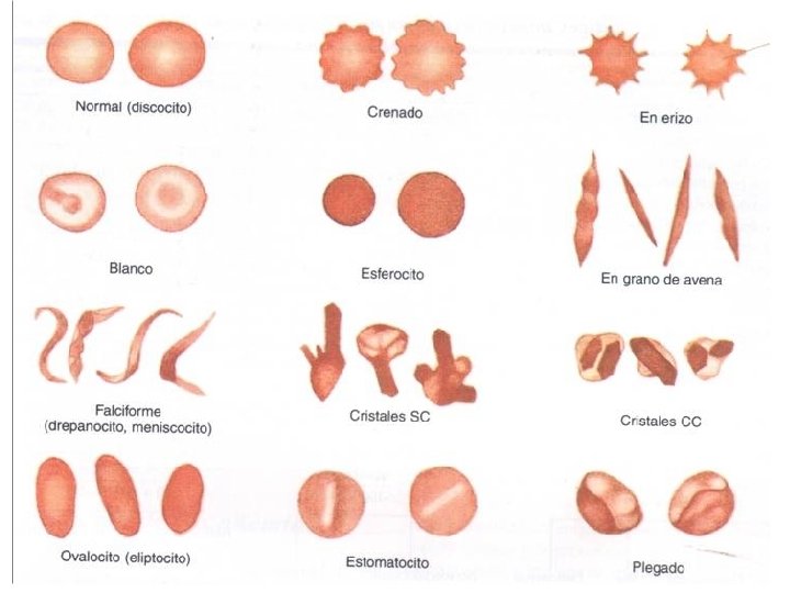 Glbulos rojos Se estudia en la muestra Su