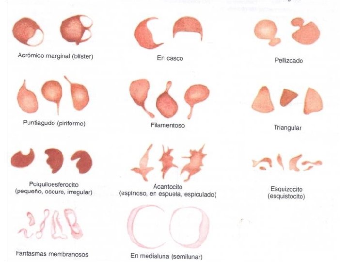 Glbulos rojos Se estudia en la muestra Su
