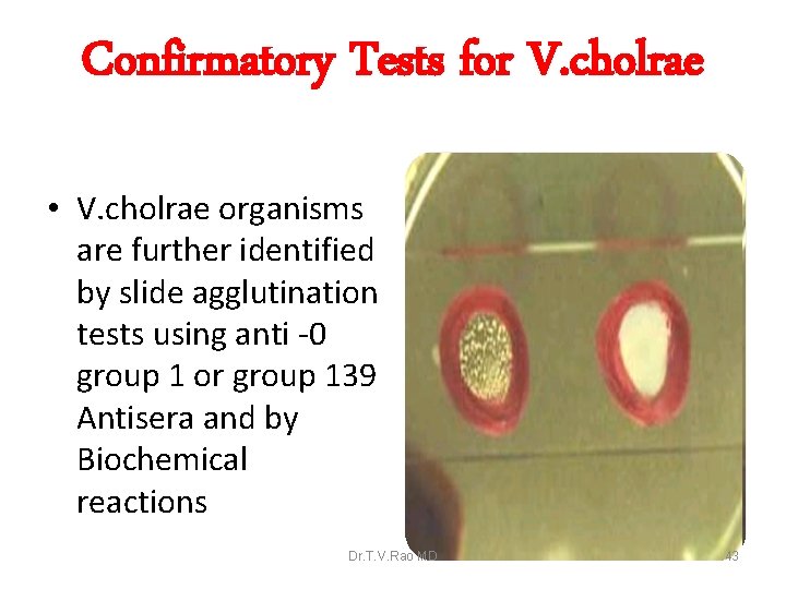 Vibrio cholerae update Dr T V Rao MD