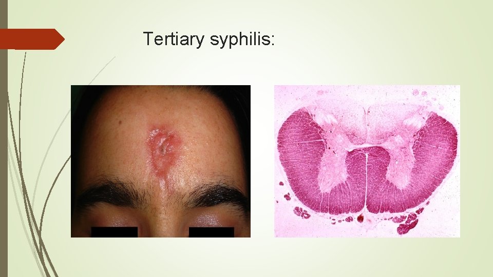 Gynecological Infections Gynecological Infections 1 STDs Abdullah Ayyoub