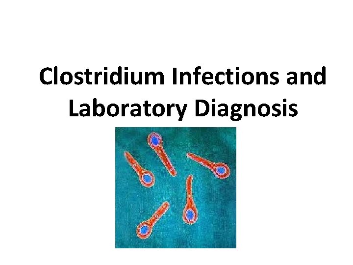 Clostridium Infections and Laboratory Diagnosis family Clostridiaceae genus