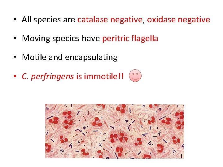Clostridium Infections and Laboratory Diagnosis family Clostridiaceae genus