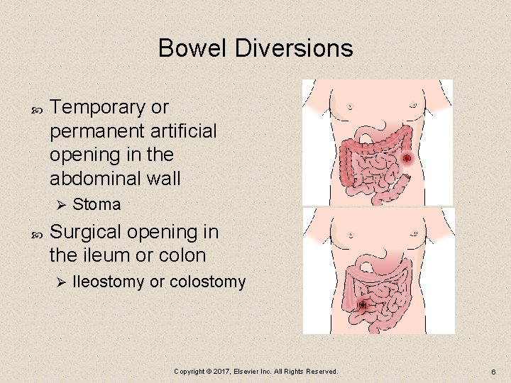 Chapter 47 Bowel Elimination Copyright 2017 Elsevier Inc