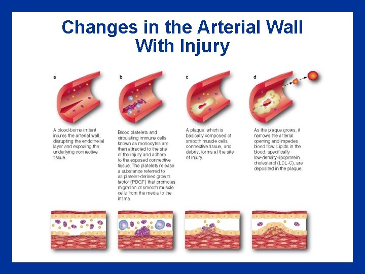 chapter 20 Cardiovascular Disease and Physical Activity Learning