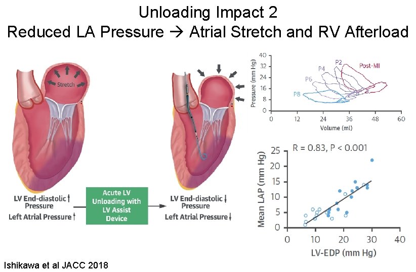 The Importance of Ventricular Unloading in Cardiogenic Shock
