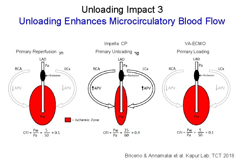 The Importance of Ventricular Unloading in Cardiogenic Shock