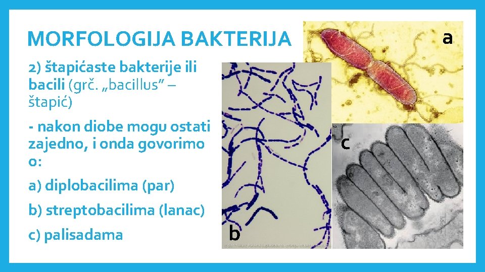 3 MORFOLOGIJA MIKROORGANIZAMA Medicinska kola u Rijeci III5