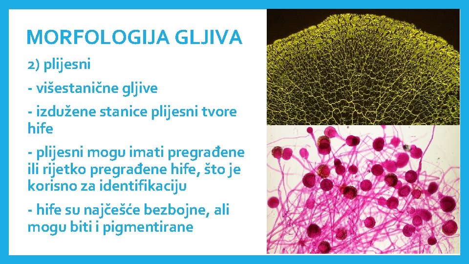 3 MORFOLOGIJA MIKROORGANIZAMA Medicinska kola u Rijeci III5