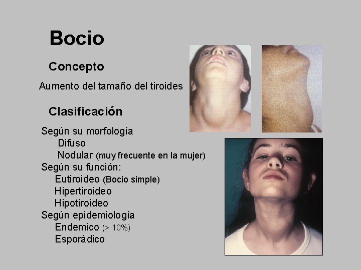 FISIOPATOLOGIA TIROIDEA BOCIO HIPERFUNCIN TIROIDEA HIPOFUNCION TIROIDEA ...