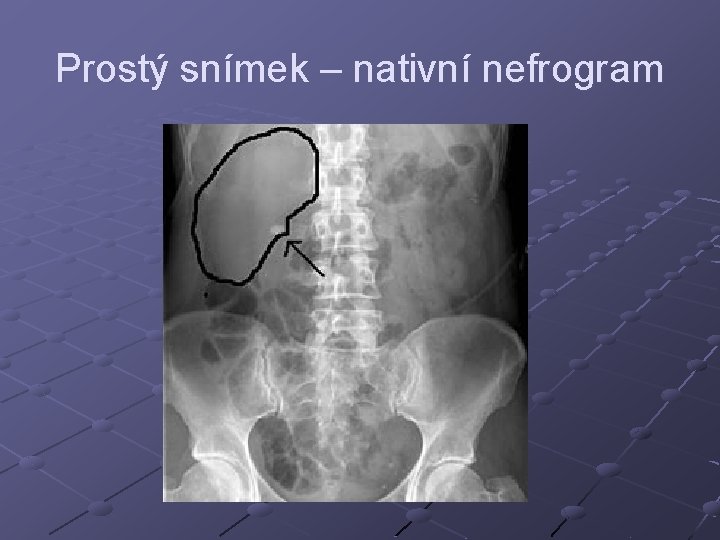 Anatomie ledvin a vvodnch cest moovch Radiodiagnostika ledvin