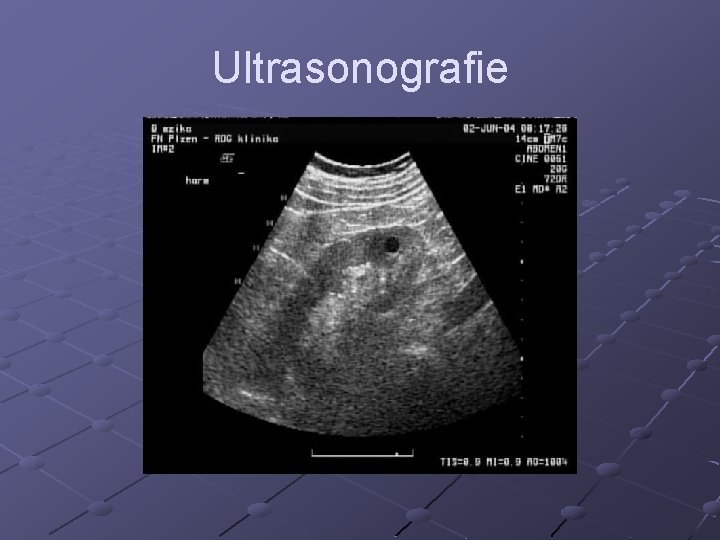 Anatomie ledvin a vvodnch cest moovch Radiodiagnostika ledvin