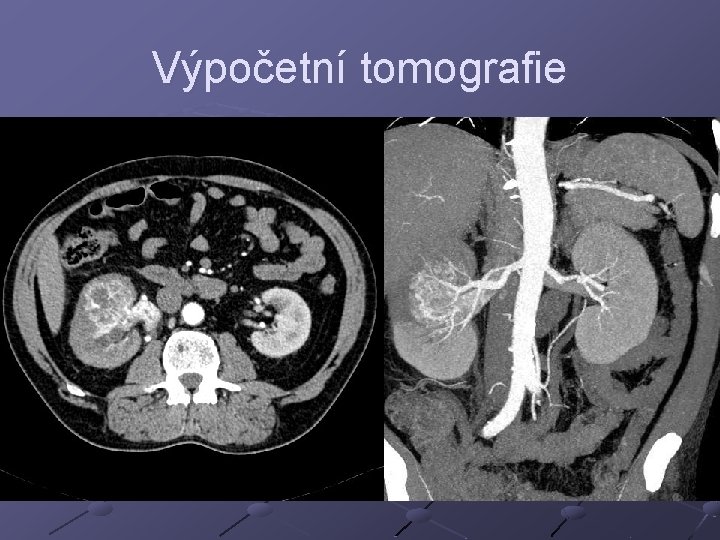 Anatomie ledvin a vvodnch cest moovch Radiodiagnostika ledvin