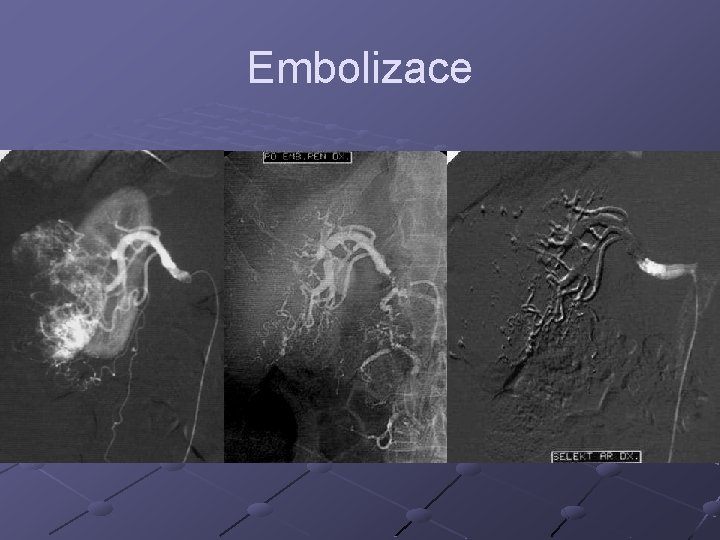 Anatomie ledvin a vvodnch cest moovch Radiodiagnostika ledvin