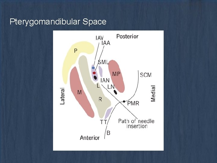 BDS 3 PCPC Review Alginates Irreversible hydrocolloid impression