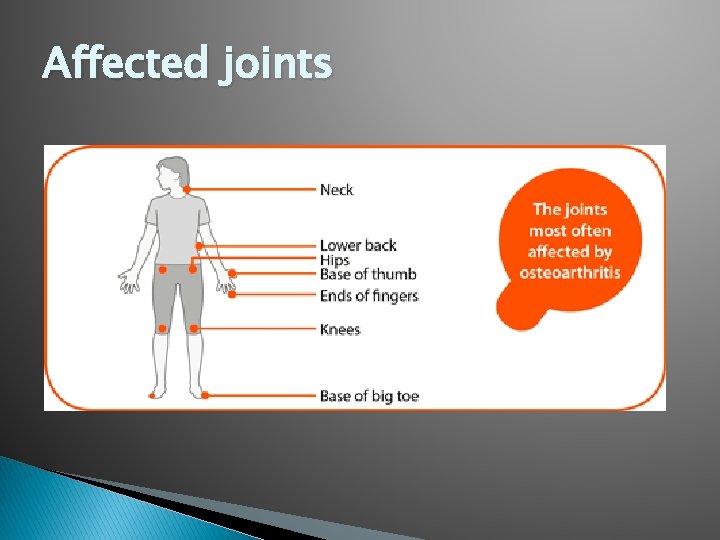 Osteoarthritis Nichola Caiger F 1 Objectives To refresh