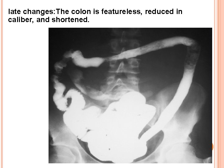 Inflammatory Bowel Disease IBD The main objectives of