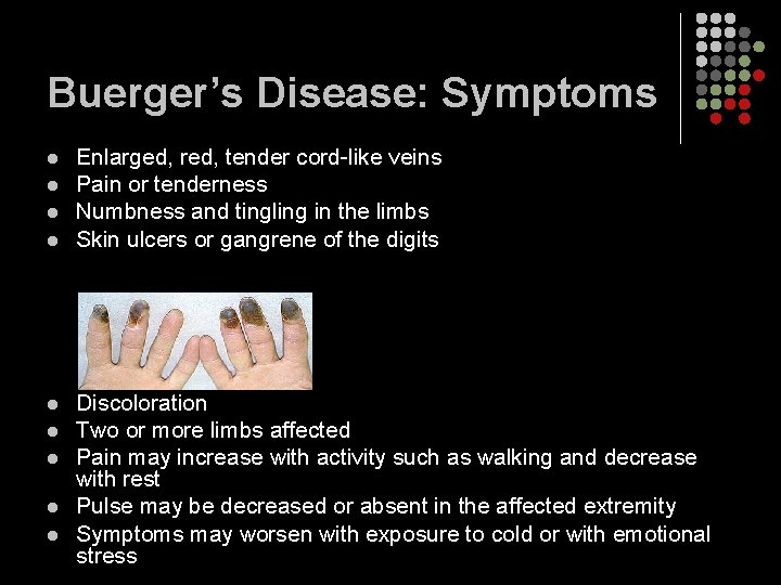 Buergers Disease A presentation by Jennifer KentBaker Buergers