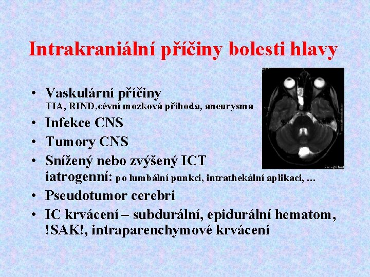 Bolesti hlavy diferenciln diagnostika kazuistika MUDr Daniel Groh