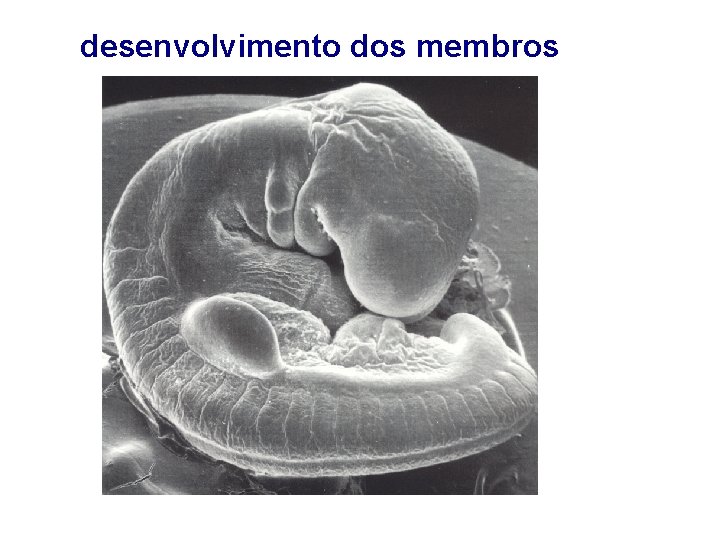 Embriologia Humana Aula 5 Osteognese e formao dos