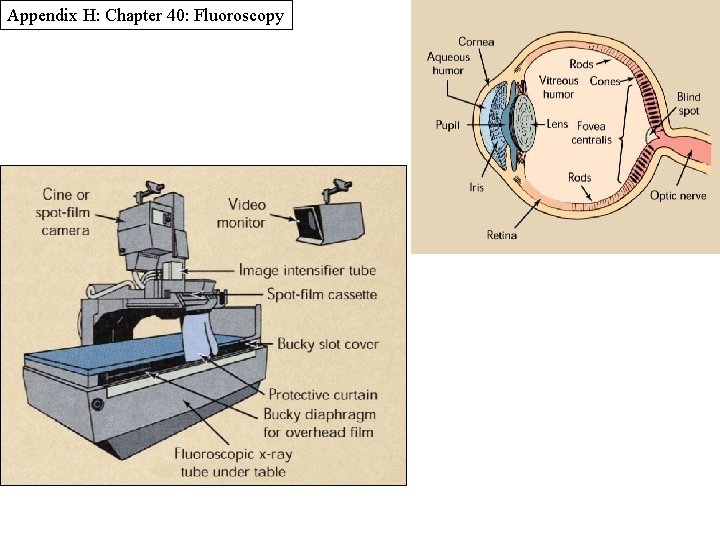 Appendix H Chapter 40 Fluoroscopy Spot film camera