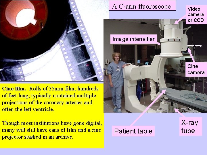 Appendix H Chapter 40 Fluoroscopy Spot film camera