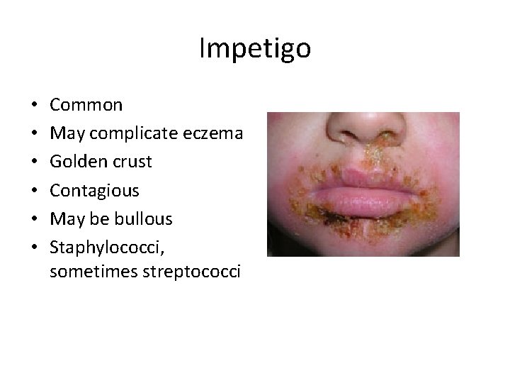 Skin infections and infestations Julia Schofield What are