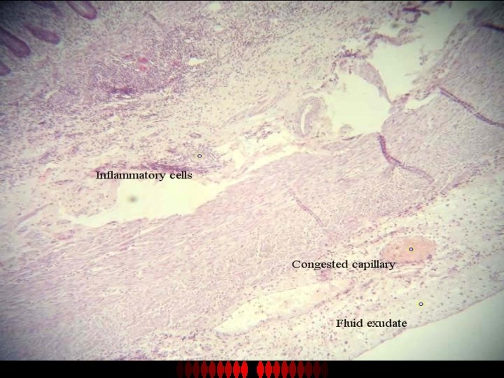 Practical 3 Acute inflammation 1032016 Contents Slide Acute