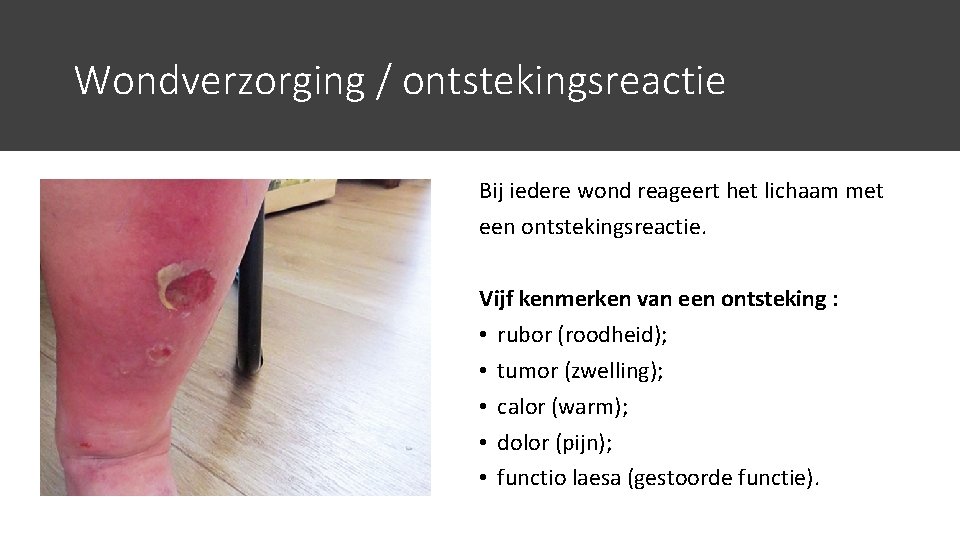 Behandelen Wondverzorging MTH voor DA H 6 22