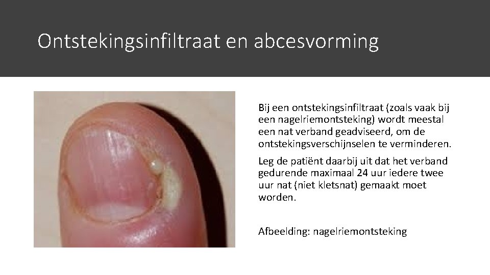 Behandelen Wondverzorging MTH voor DA H 6 22