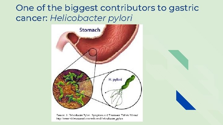 How does Cag A in H pylori contribute