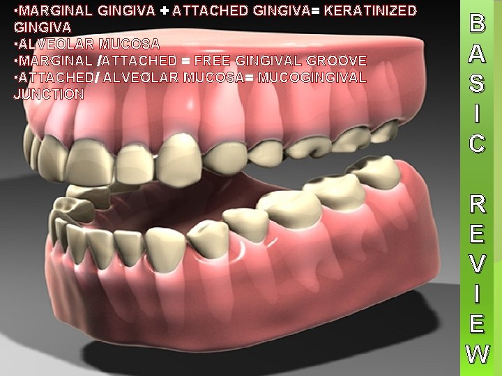 GINGIVAL RECESSION v DEFINITION v CLASSIFICATION v FACTORS