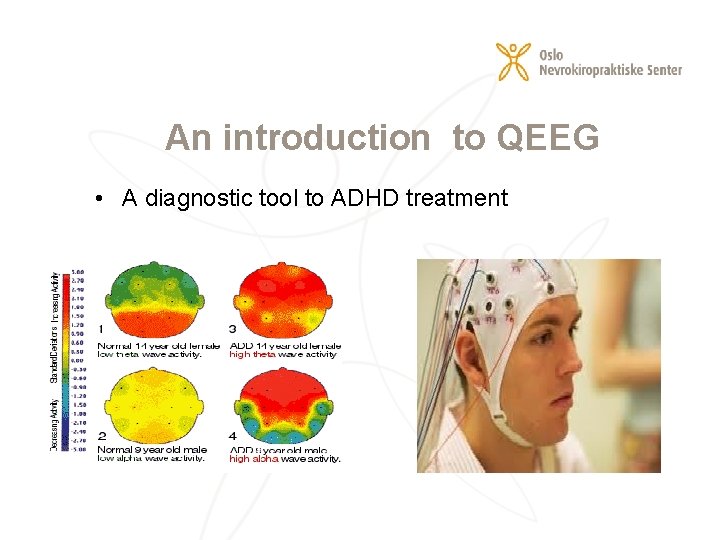 An introduction to QEEG A diagnostic tool to