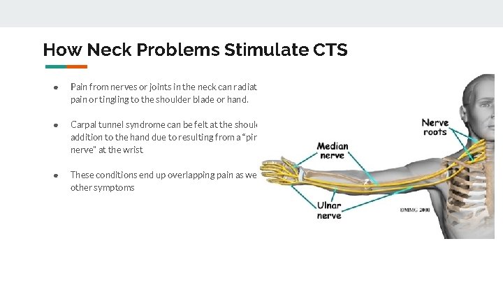 Carpal Tunnel Syndrome Dr Romina Ghassemi D C