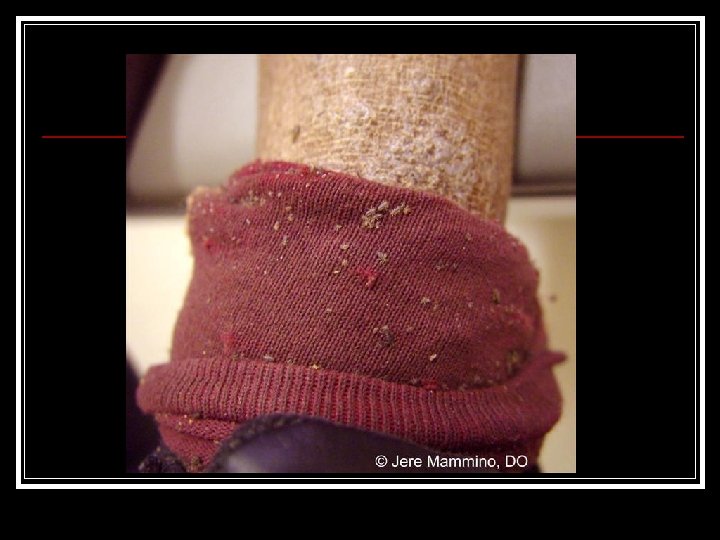 Trench Warfare The causes dangers and lasting problems