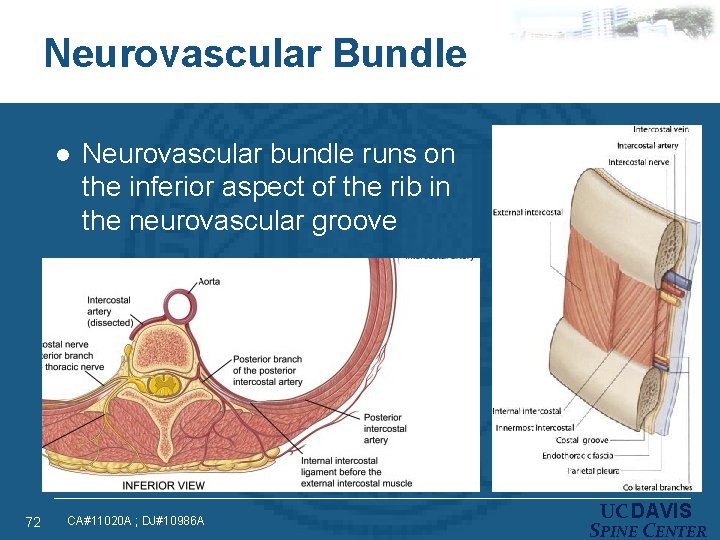 Adult Spinal Deformity Planning Your Osteotomy Surgical Management