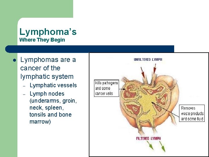 Haematological Neoplasia l l l Leukemias Acute Chronic