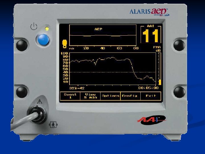 AEP Monitor Auditory Evoked Potential Contents 1 2AEP