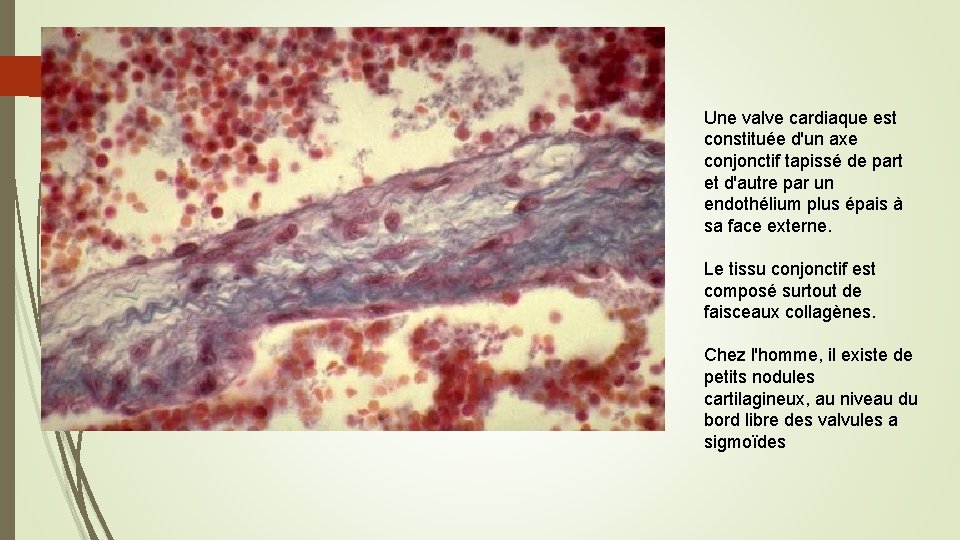 Le squelette fibreux du cur Les valves cardiaques