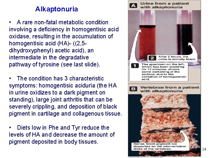 Dental Biochemistry Lecture 25 Amino acidopathies defects in