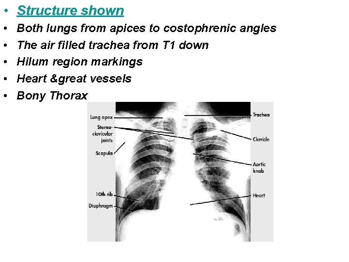 Lecture 21 Indications for chest Radiography Clinical Problem