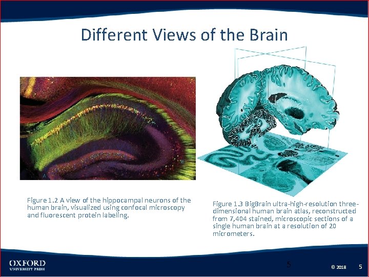 1 Introduction Cognitive Neuroscience David Eagleman Jonathan Downar