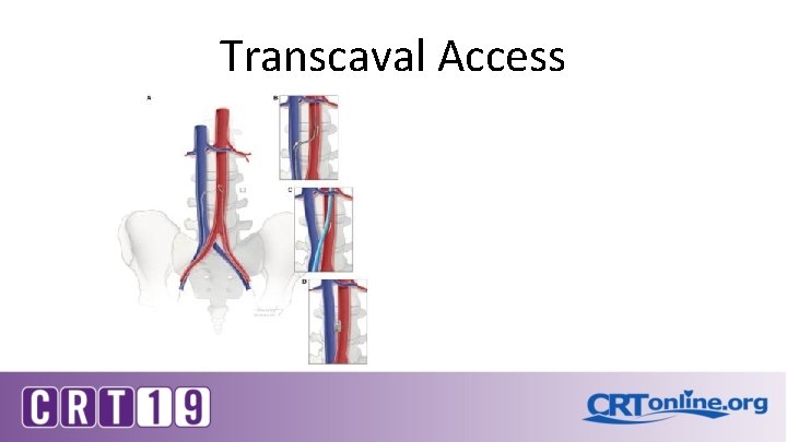 TAVR 2016 Requirements for the Cath Lab TAVR